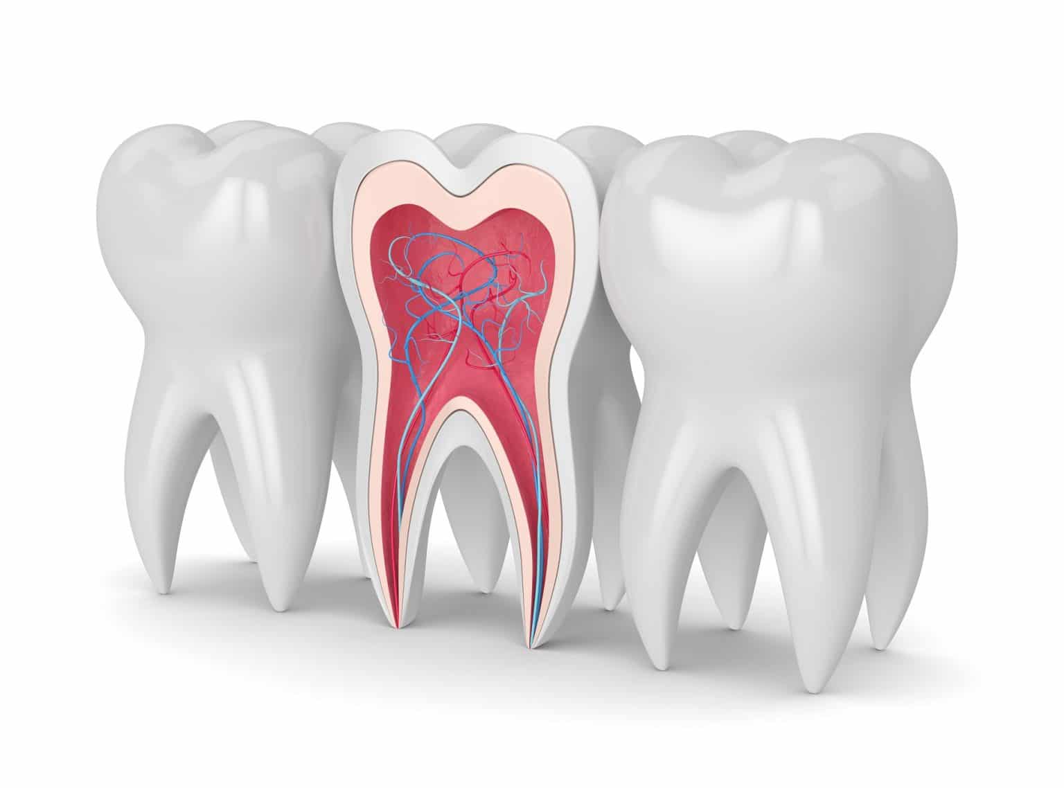 When Treating Tooth Decay Requires Root Canal Therapy | Dallas, TX